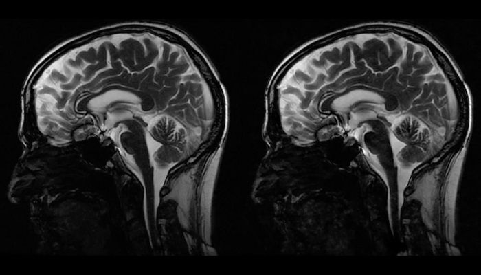 La risonanza magnetica portatile diventa realtà, approvata dalla FDA